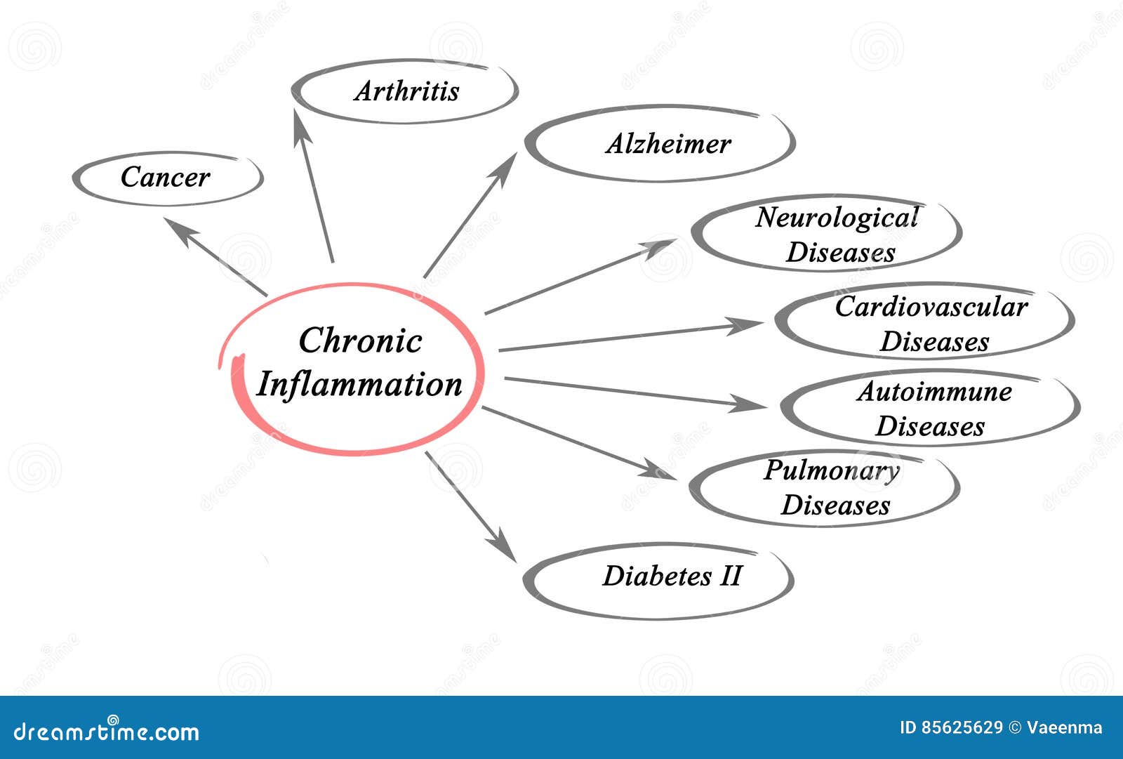 Chronic Inflammation stock illustration. Illustration of cardiovascular ...
