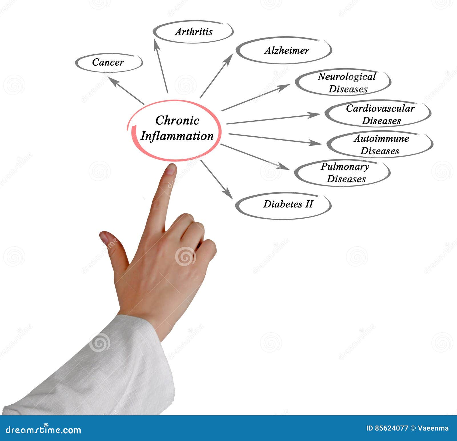 Chronic Inflammation stock image. Image of doctor, medical - 85624077