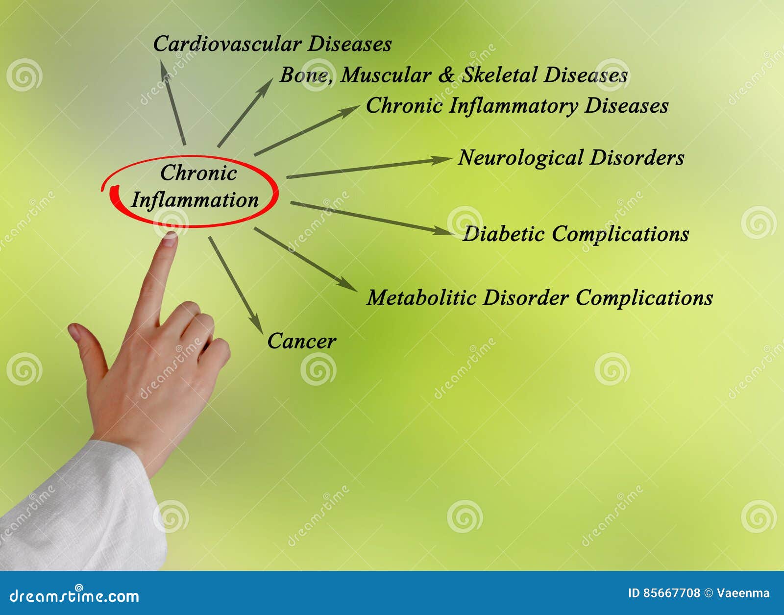 Chronic Inflammation stock photo. Image of help, consulting - 85667708
