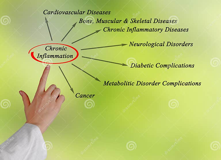 Chronic Inflammation stock photo. Image of help, consulting - 85667708