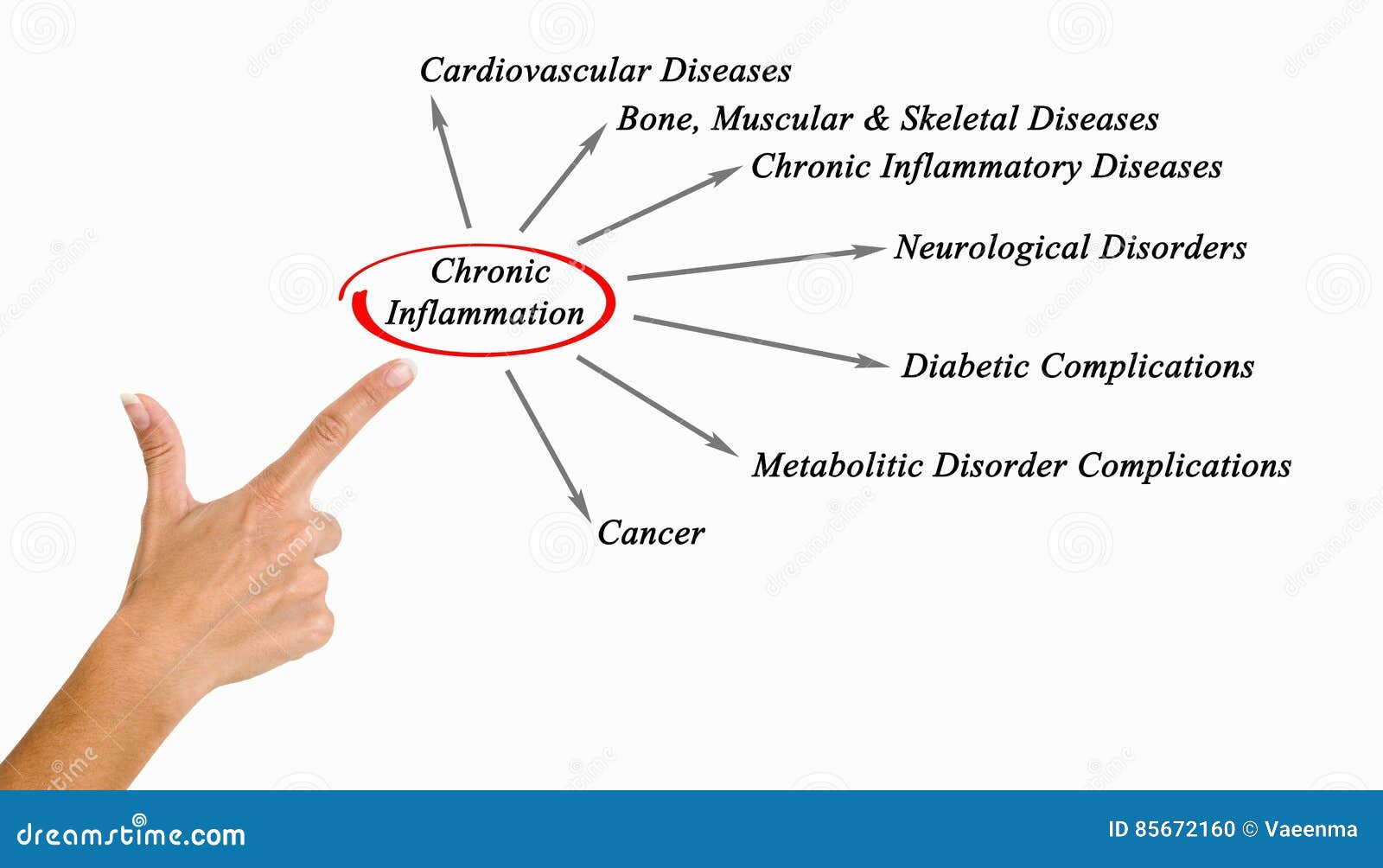 Chronic Inflammation stock photo. Image of hand, medical - 85672160