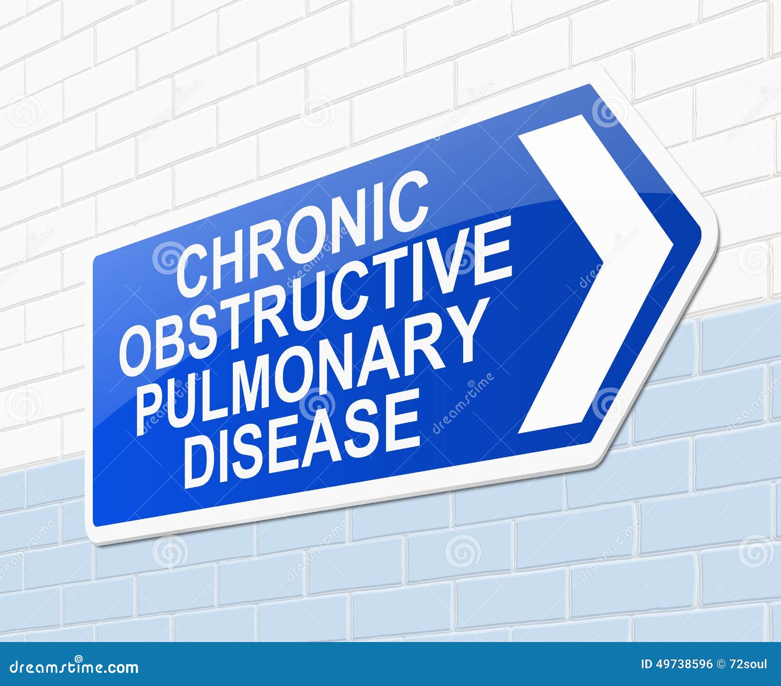 Chronic Obstructive Pulmonary Disease Concept. Stock Illustration ...