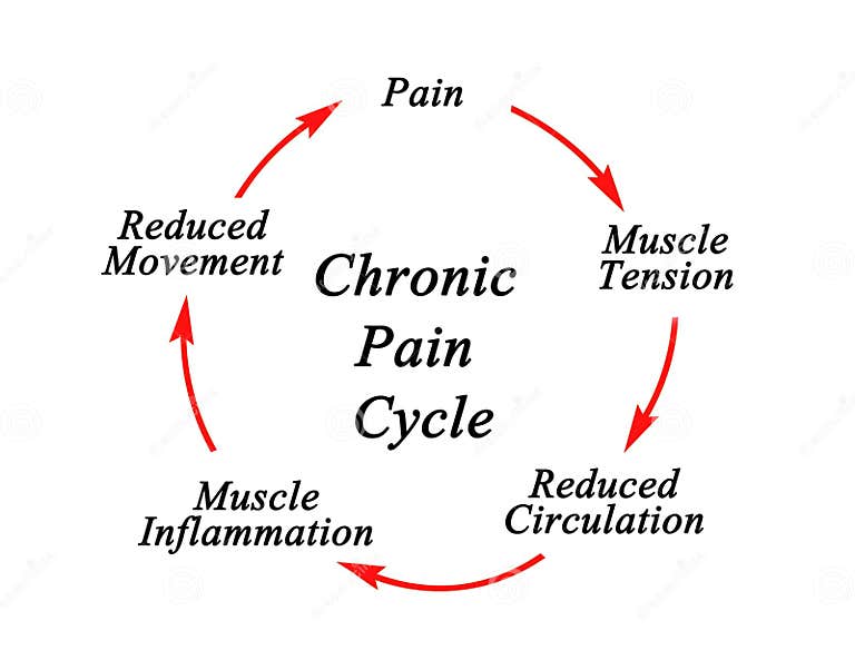 Chronic Pain Cycle stock illustration. Illustration of chronic - 169534204