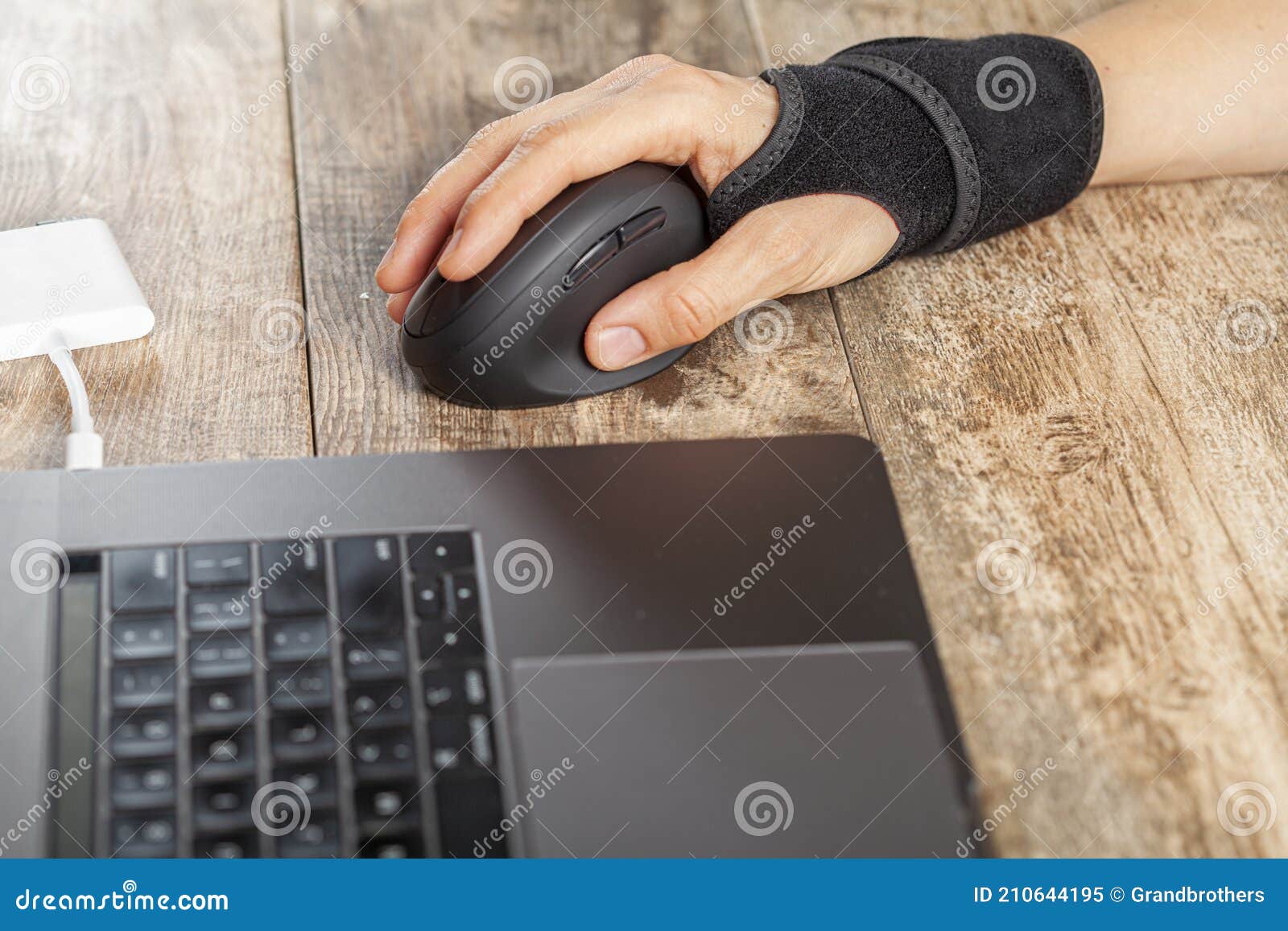 Chronic Trauma To The Wrist Joint In People Using Computer Mouse ...