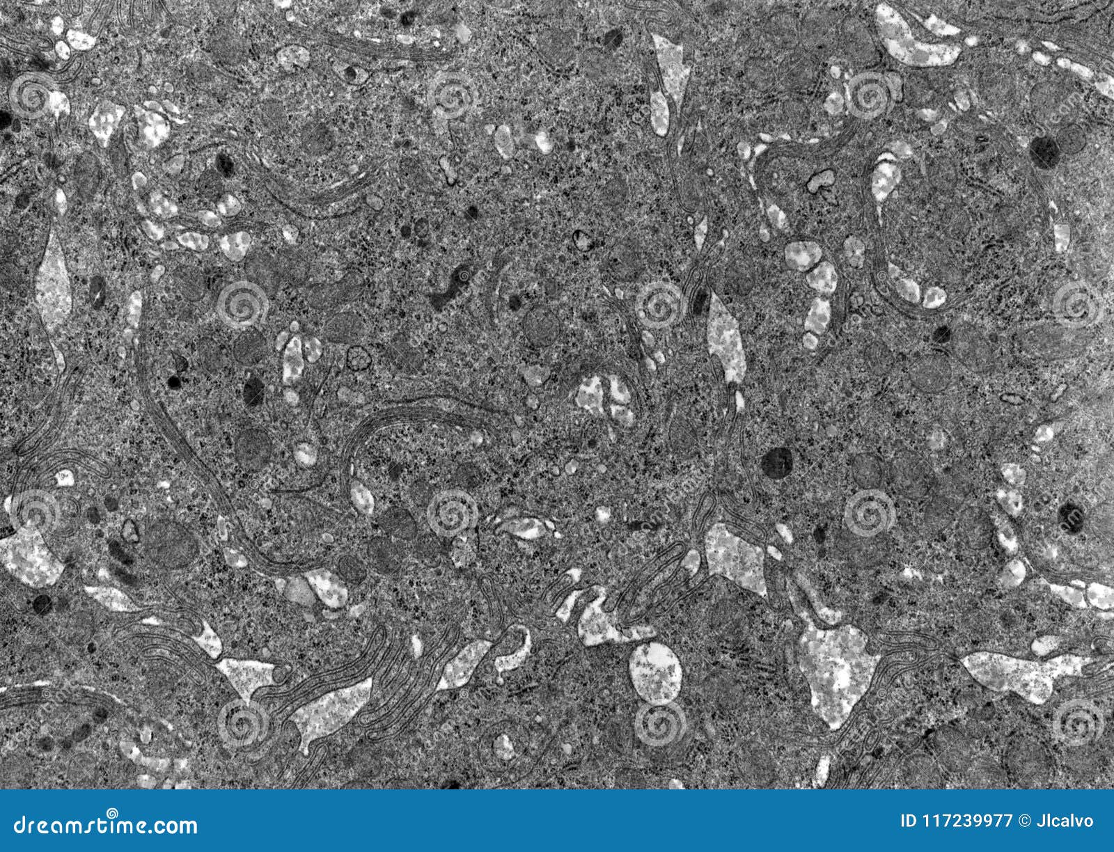 Chylomicrons Cellules Intestinales Image stock - Image of golgi ...