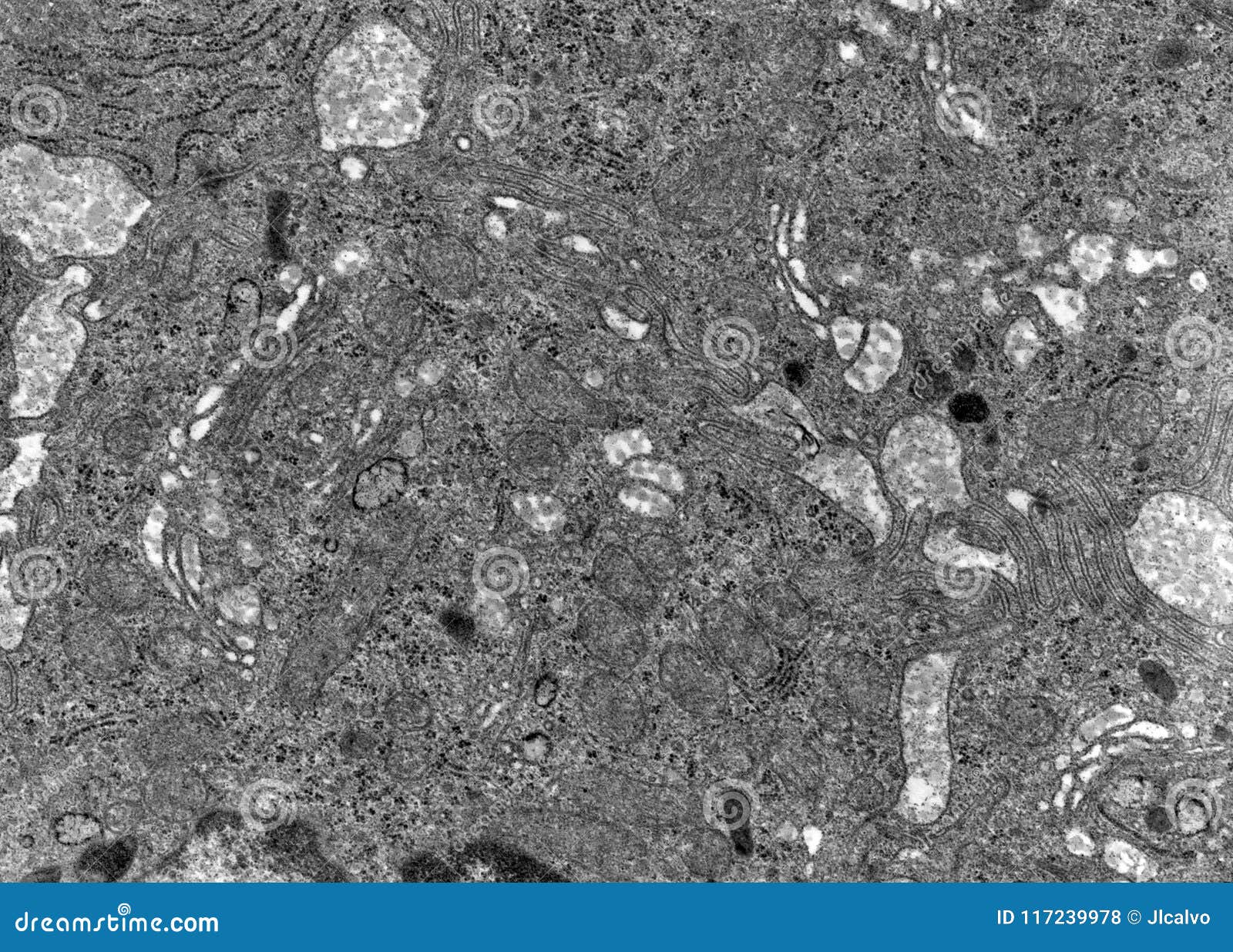 Chylomicrons. Intestinal Cells Stock Photo - Image of chylomicrons ...