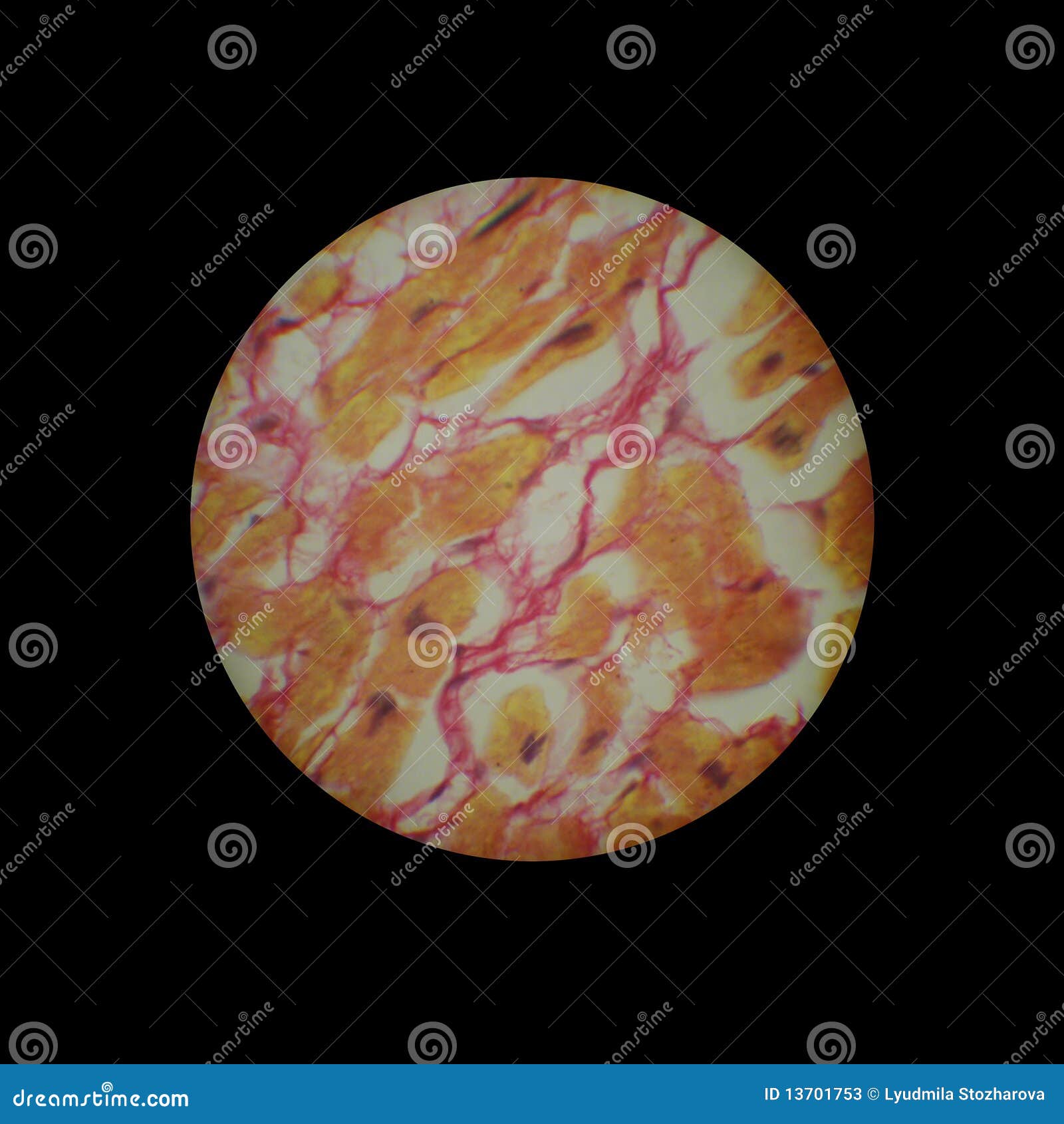 Cicatrical Myocardial Tissue Stock Image - Image of histiology ...