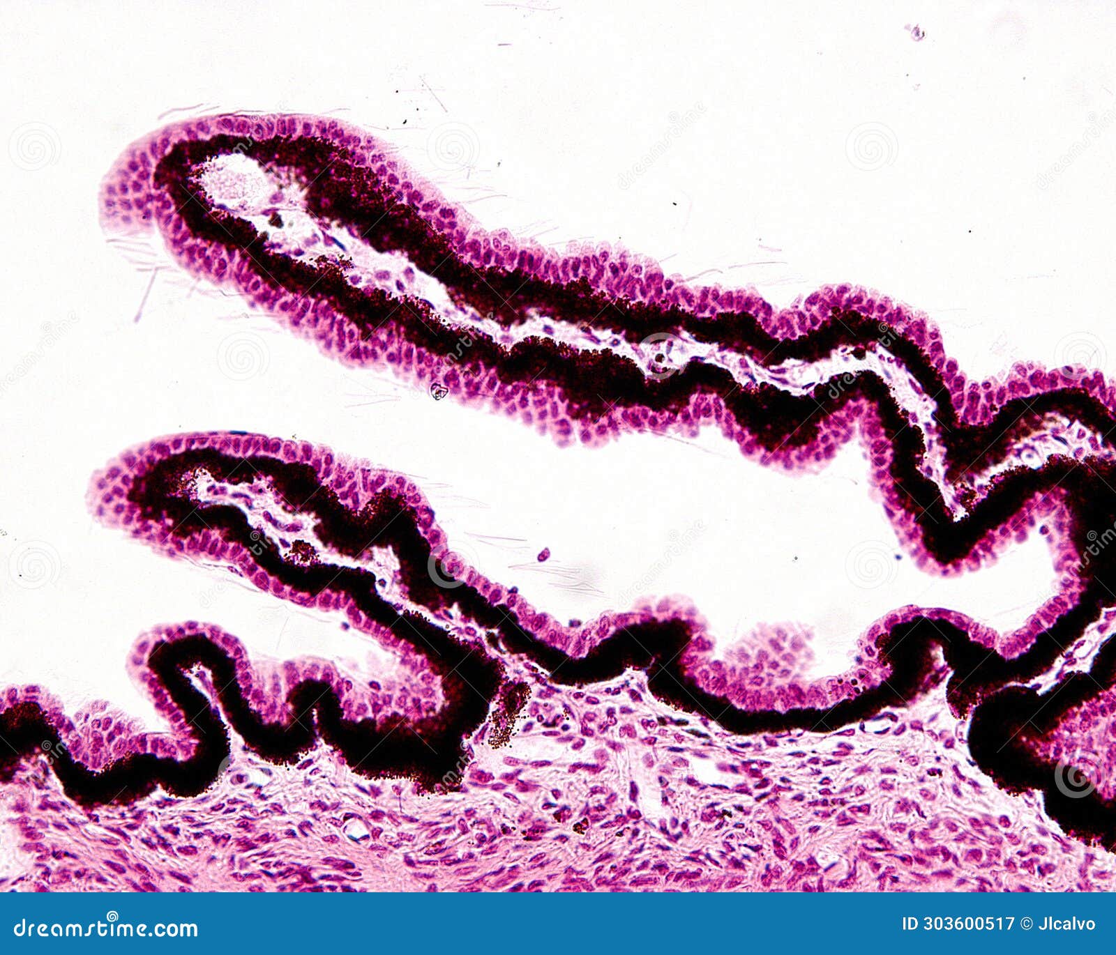 Eye. Ciliary body stock image. Image of pars, ciliary - 303600517