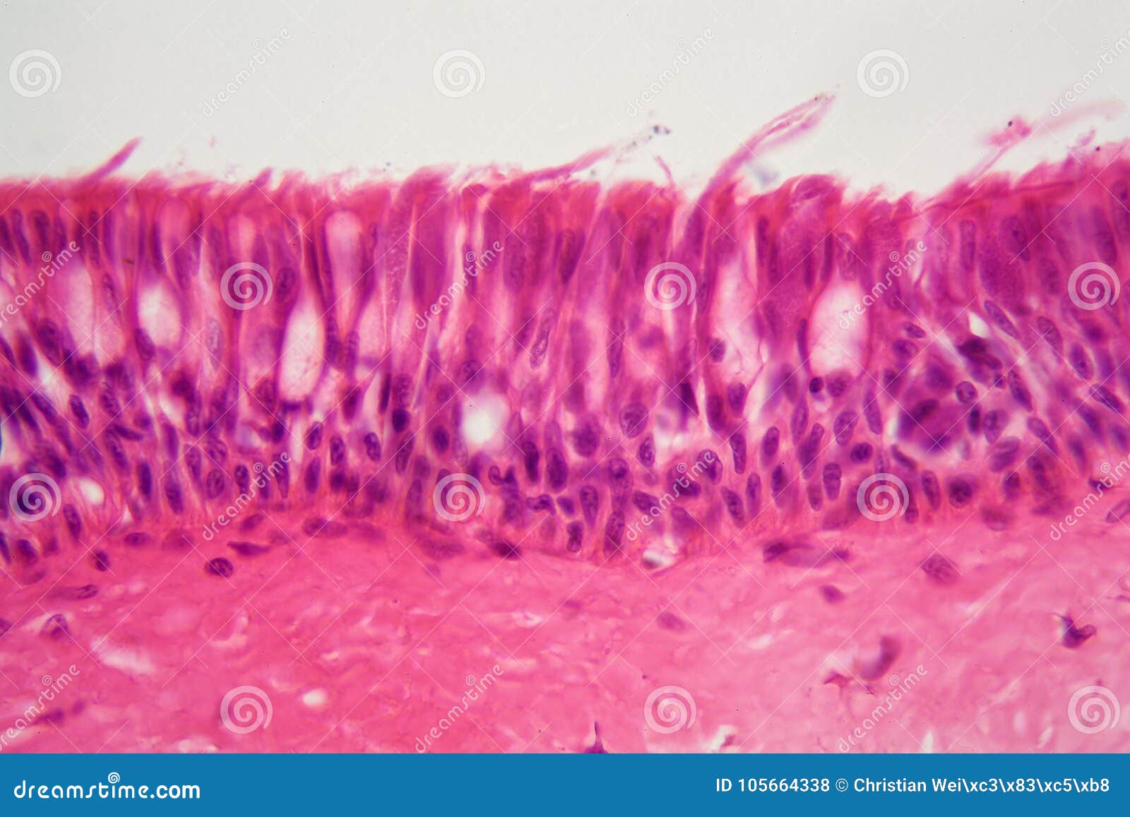 Ciliated Epithel Unter Dem Mikroskop Stockfoto - Bild von ciliated ...