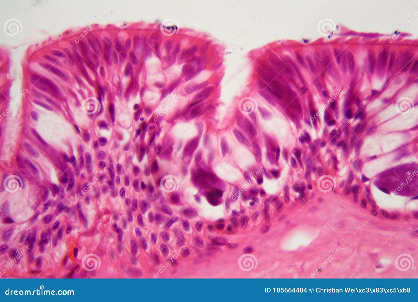 Ciliated Epithel Unter Dem Mikroskop Stockfoto - Bild von organisch ...