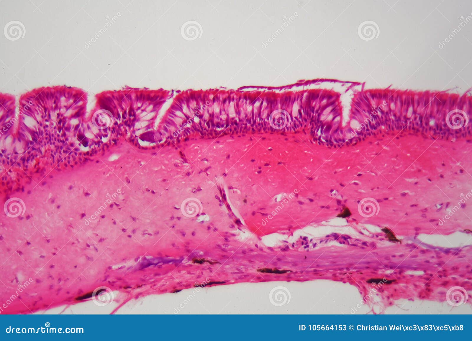 Ciliated Epithelium Labeled