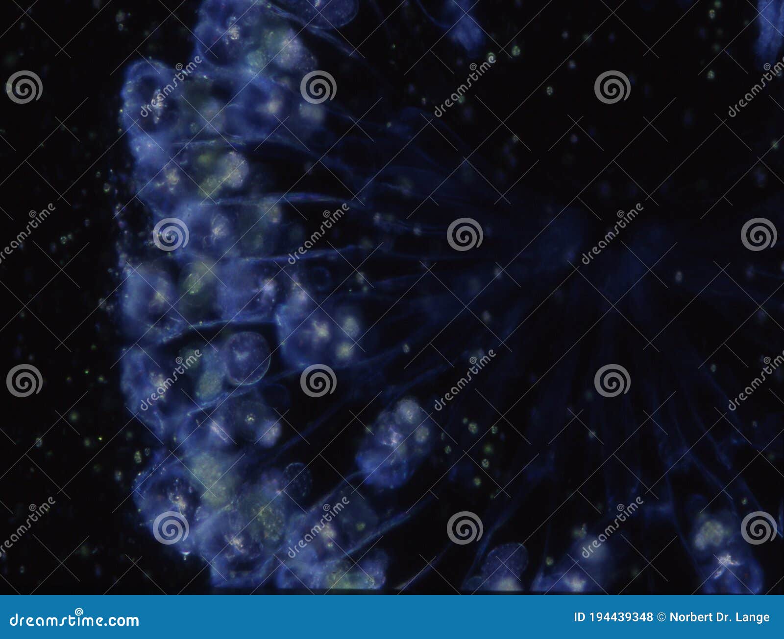 Ciliates and Amoebas in Drops of Water Stock Photo - Image of ciliat ...