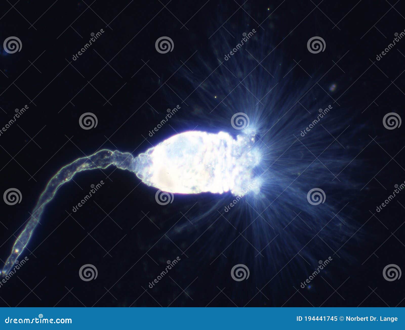 Ciliates And Amoebas In Drops Of Water Stock Photo | CartoonDealer.com ...