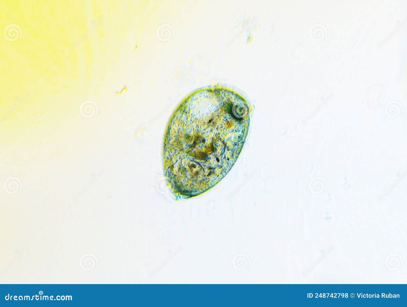 Ciliates Stentor