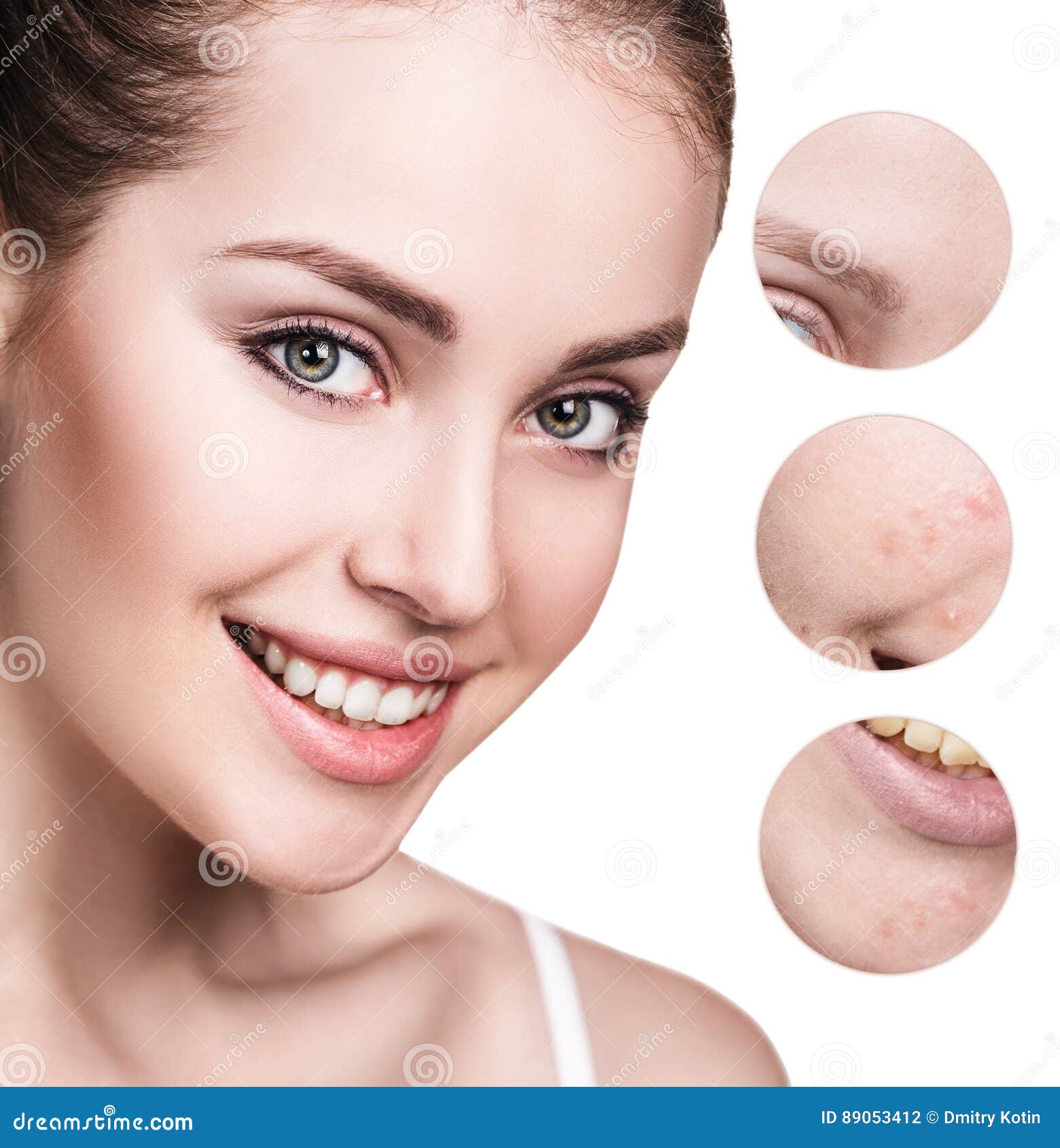 Circles Shows Problem Skin of Young Woman. Stock Photo - Image of ...
