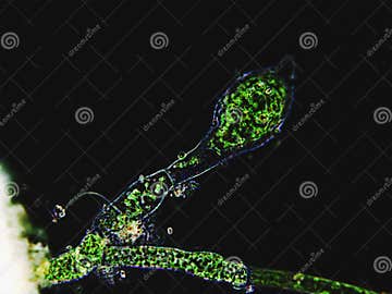 Cladophora Sp. Algae Under Microscopic View, Dark Background ...