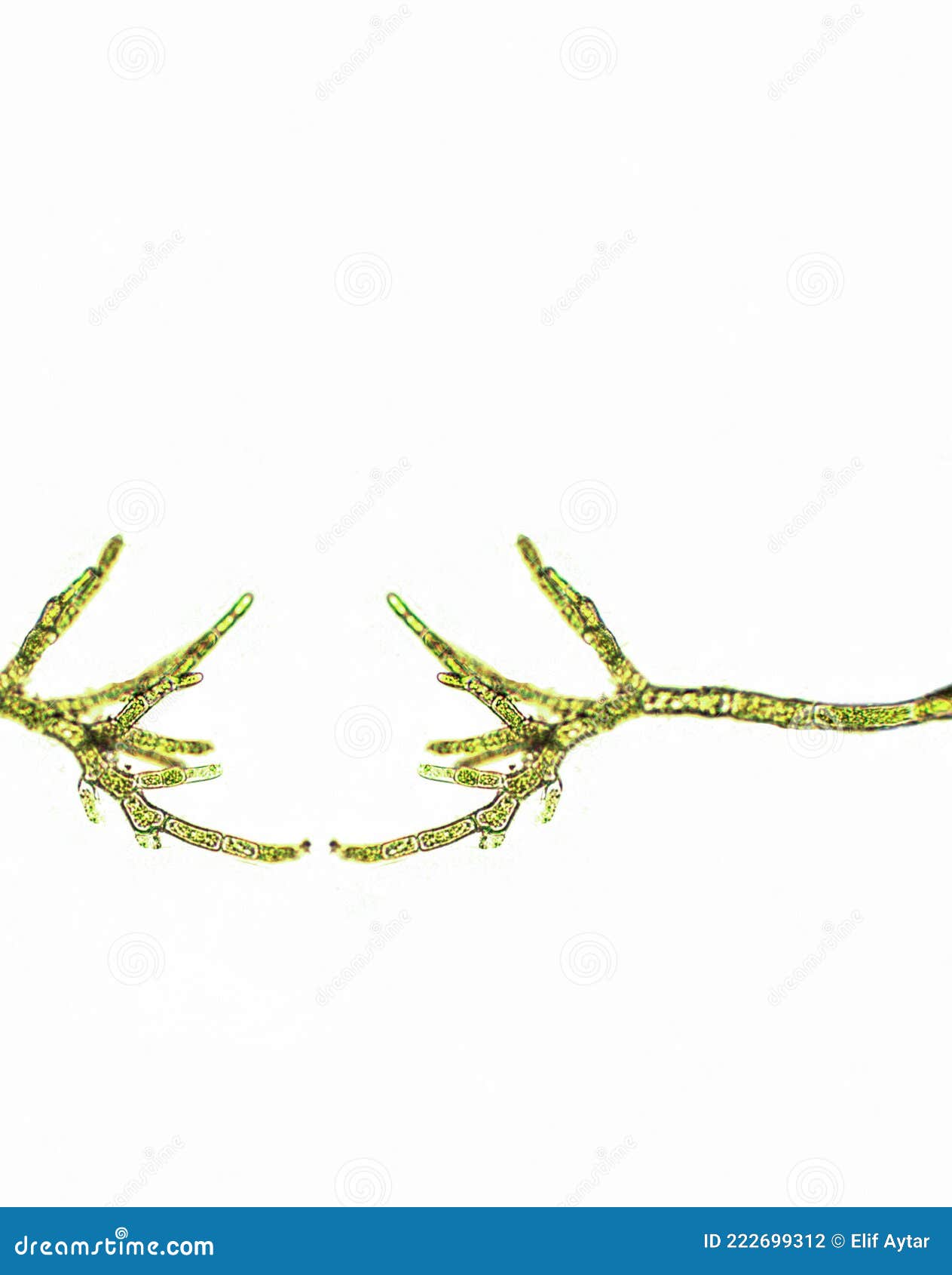 Cladophora Sp. Algae Under Microscopic View, Green Algae Stock Photo ... Cladophora Sp. Algae Under Microscopic View, Green Algae Stock Photo ...