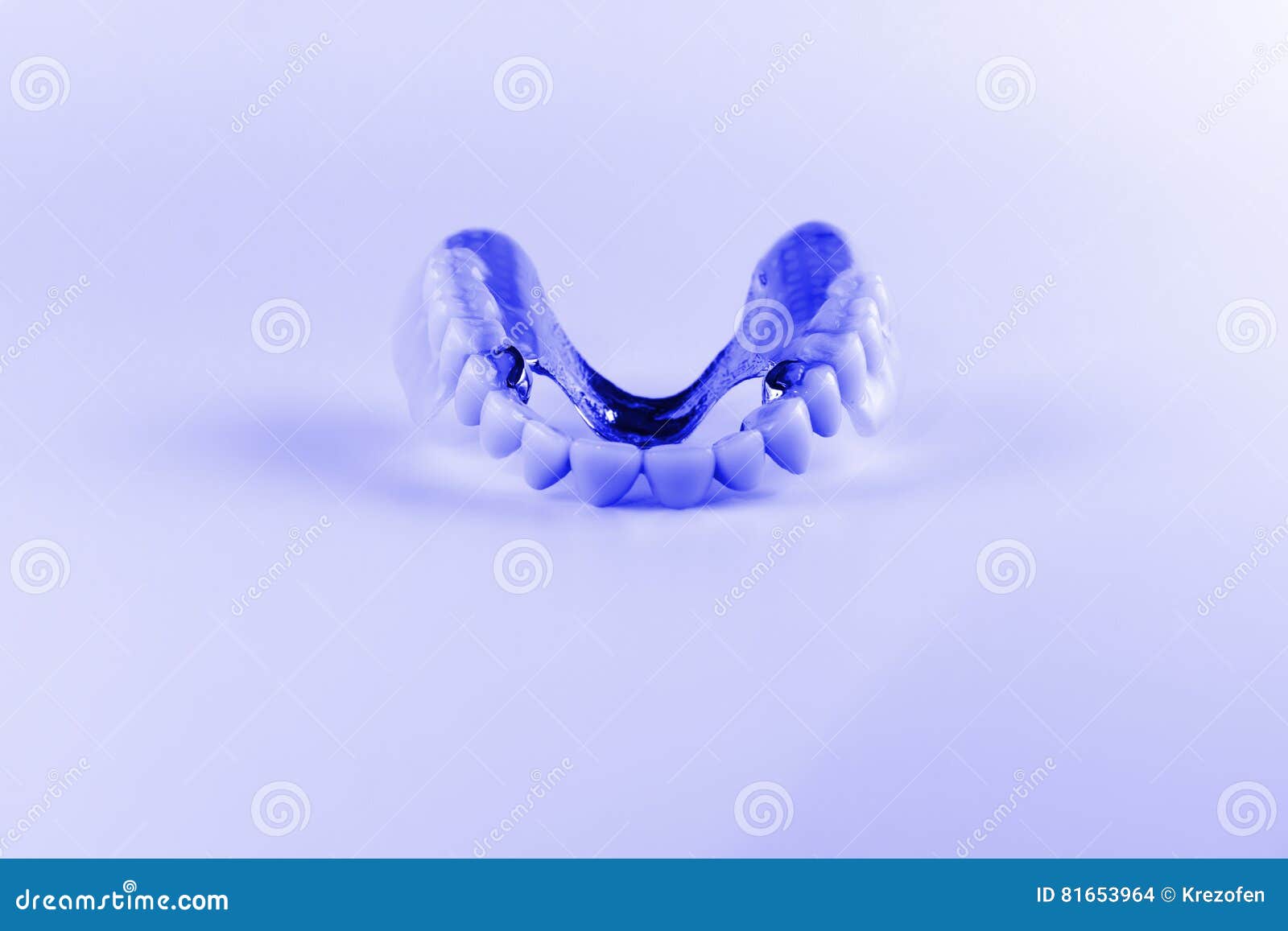 Clasp Prosthesis with Attachments Fixing Ceramic Crowns Stock Photo ...