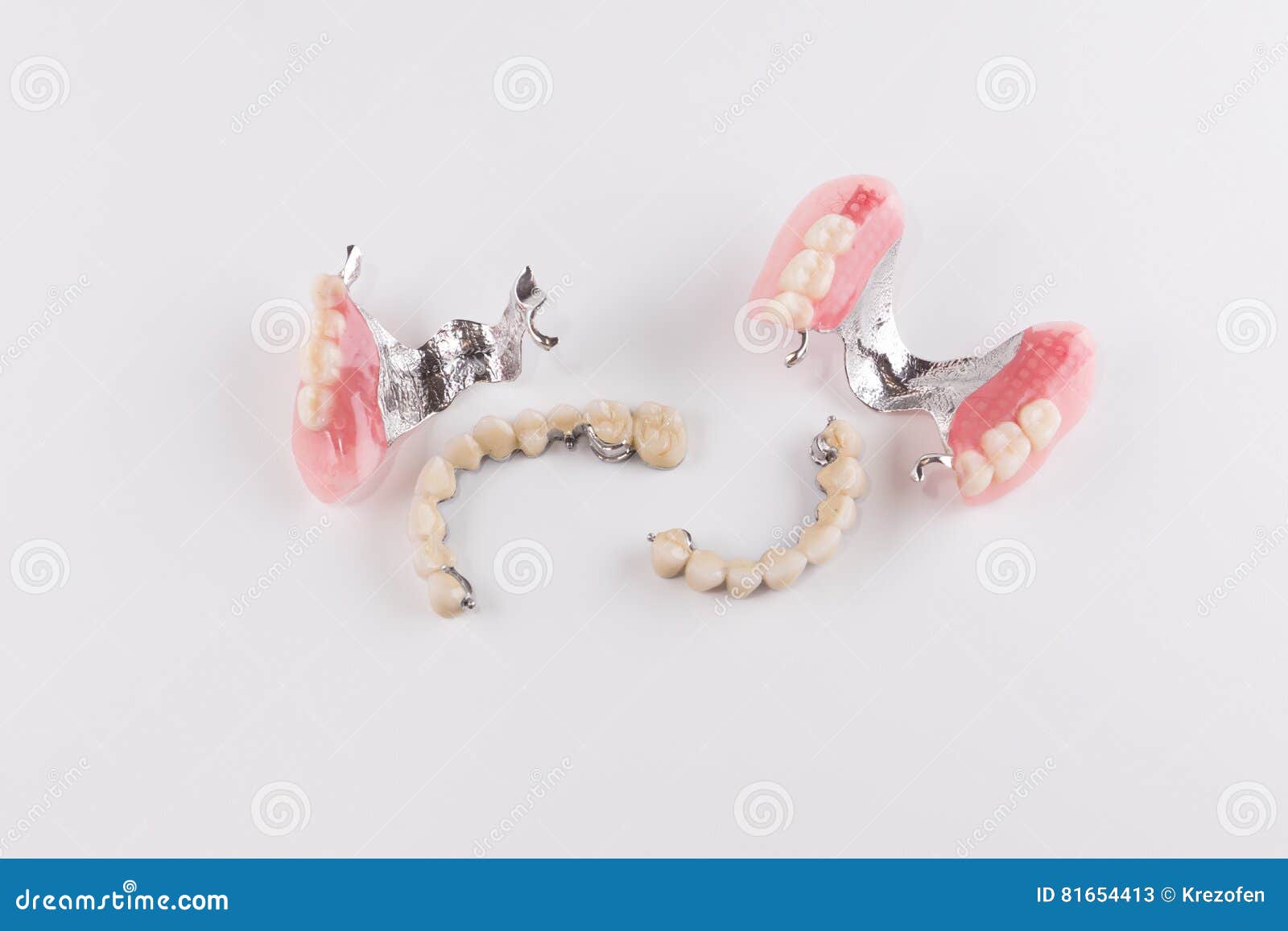 Clasp Prosthesis with Attachments Fixing Ceramic Crowns Stock Image ...