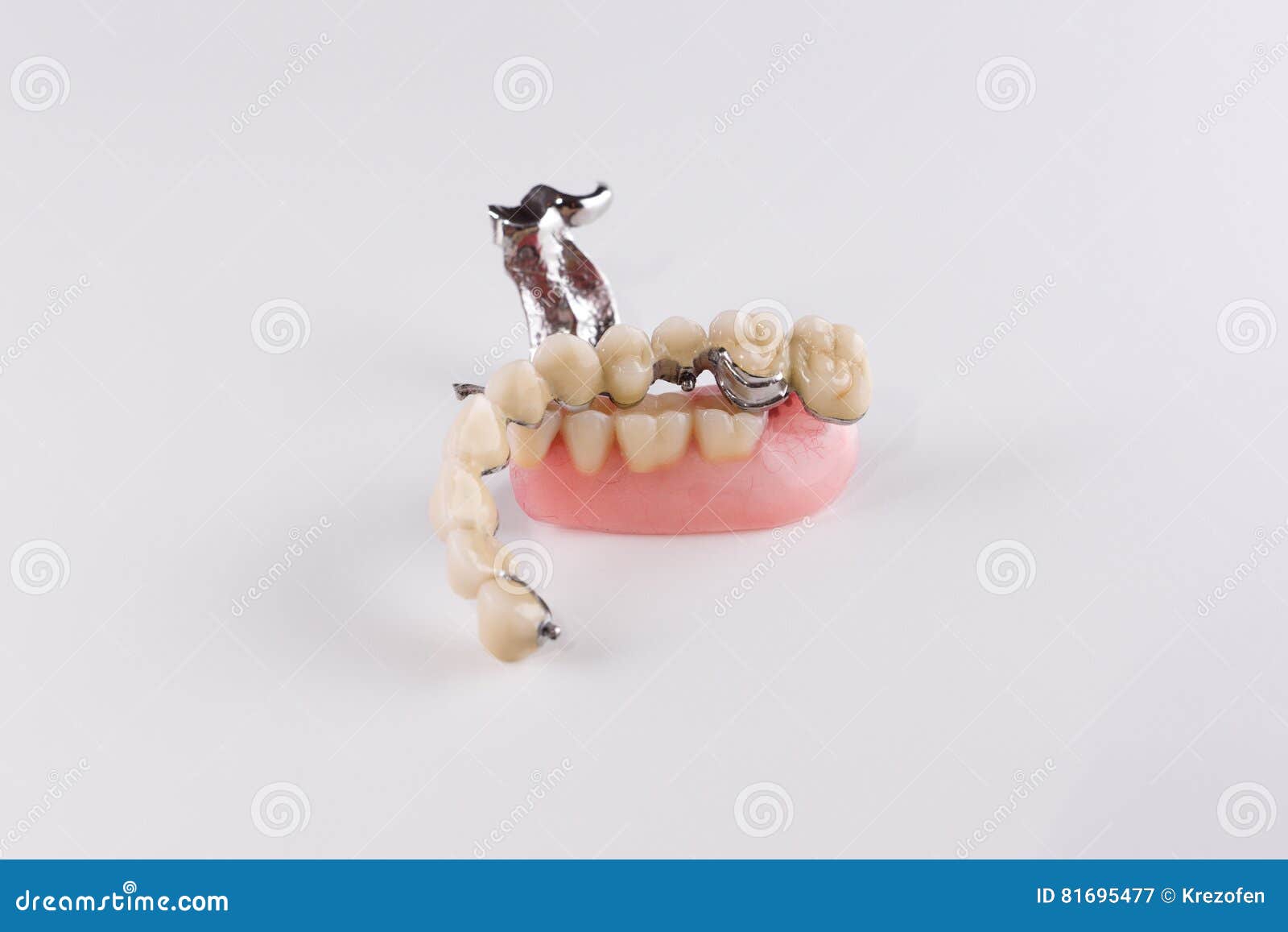 Clasp Prosthesis with Attachments Fixing Ceramic Crowns Stock Image ...