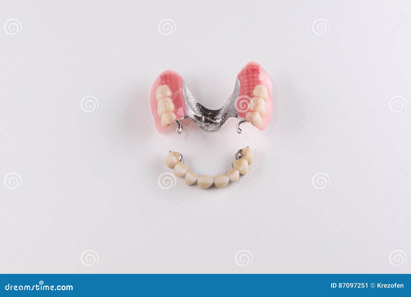 Clasp Prosthesis with Attachments Fixing Ceramic Crowns Stock Image ...