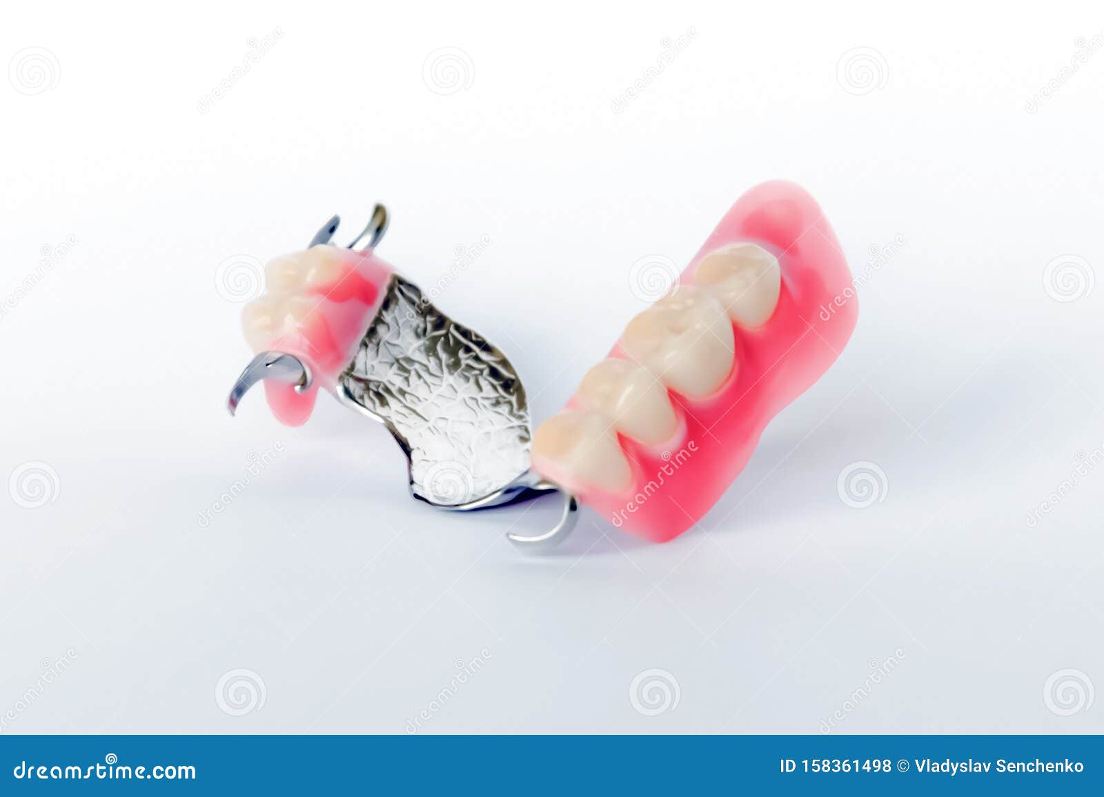 Clasp Prosthesis with Fixation Stock Photo - Image of denture, acrylic ...