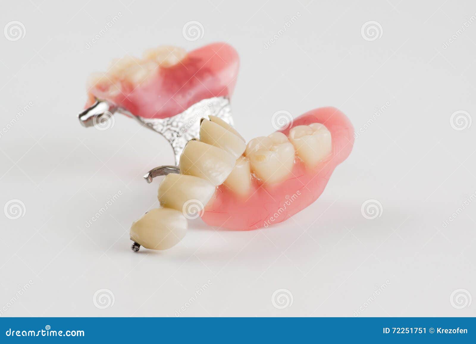 Clasp Prosthesis with and Latch Ceramic Crowns Stock Image - Image of ...