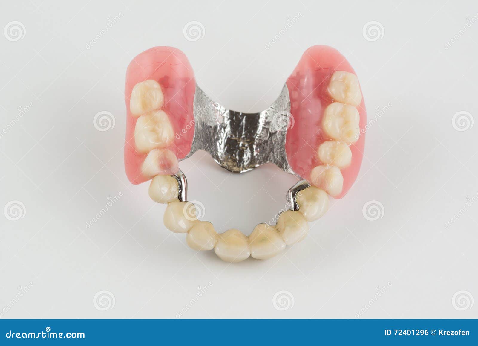 Clasp Prosthesis with and Latch Ceramic Crowns Stock Photo - Image of ...