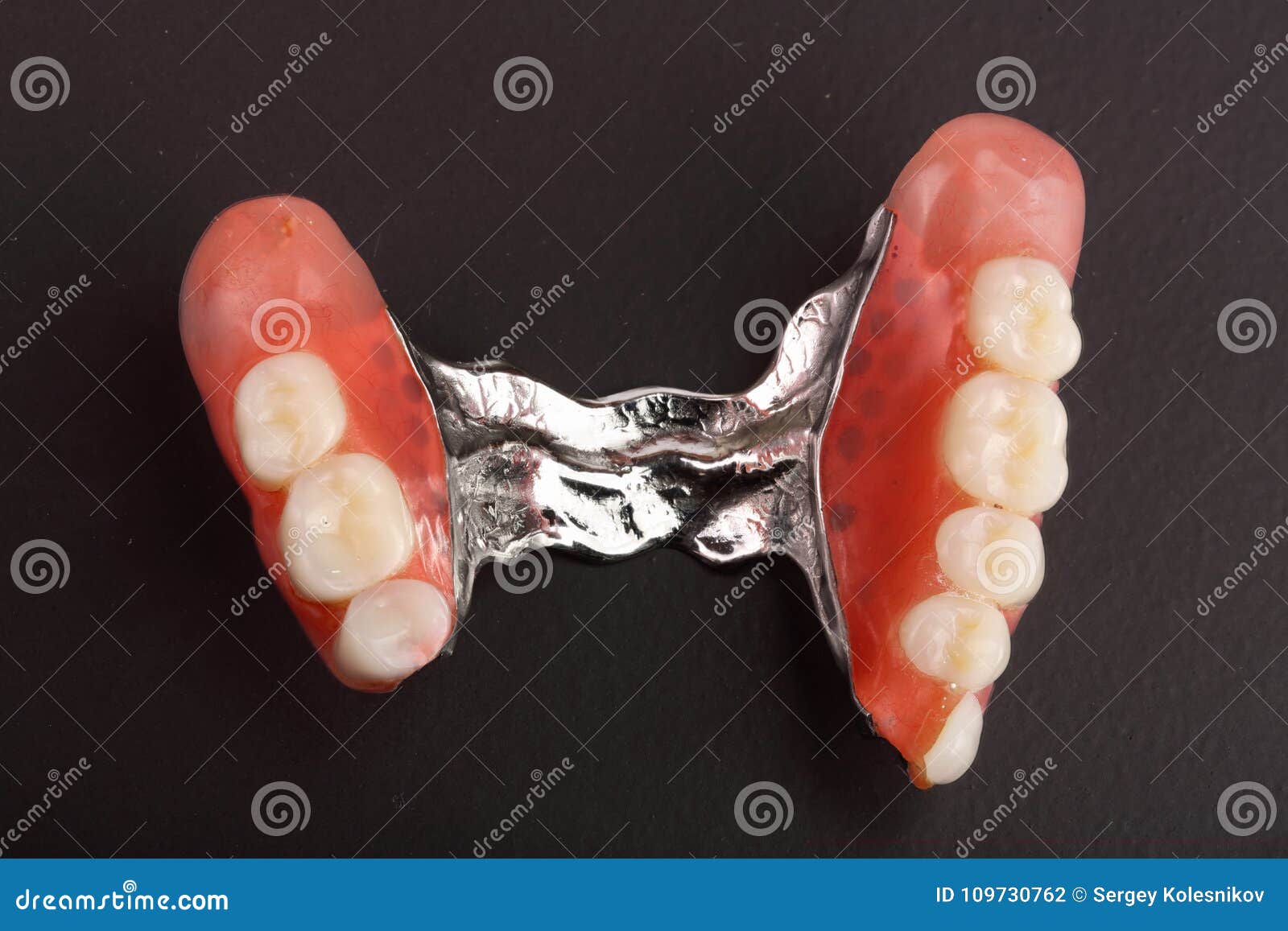 Clasp Prosthesis with Lock Fixation on Black Background Macro Stock ...