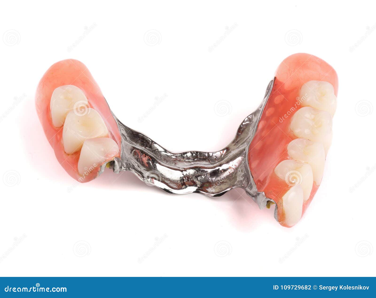 Clasp Prosthesis with Lock Fixation Isolated on White Background Macro ...