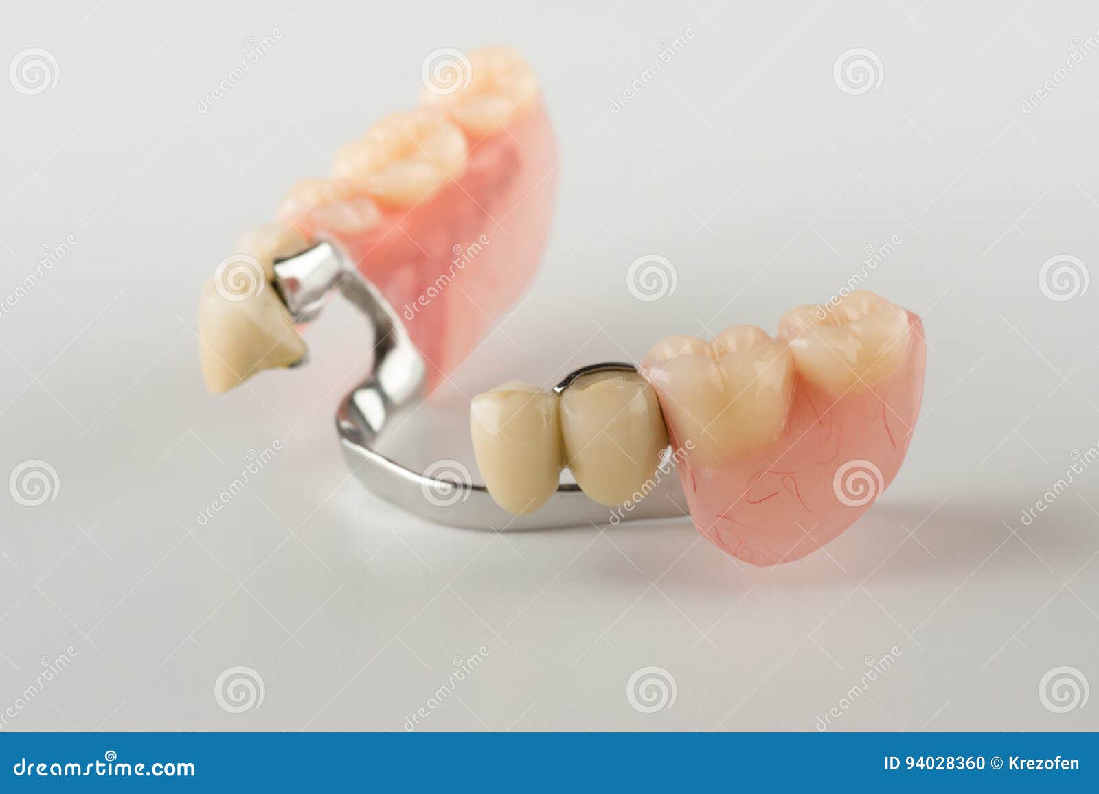 Clasp Prosthesis with Lock Fixation Stock Photo - Image of close ...