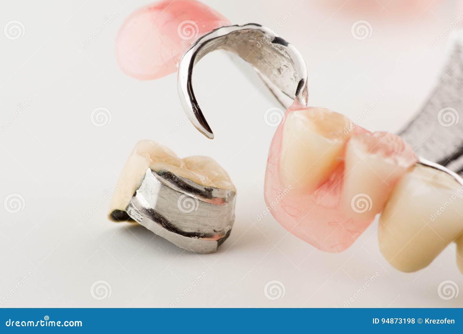 Clasp Prosthesis with Lock Fixation Stock Photo - Image of healthcare ...