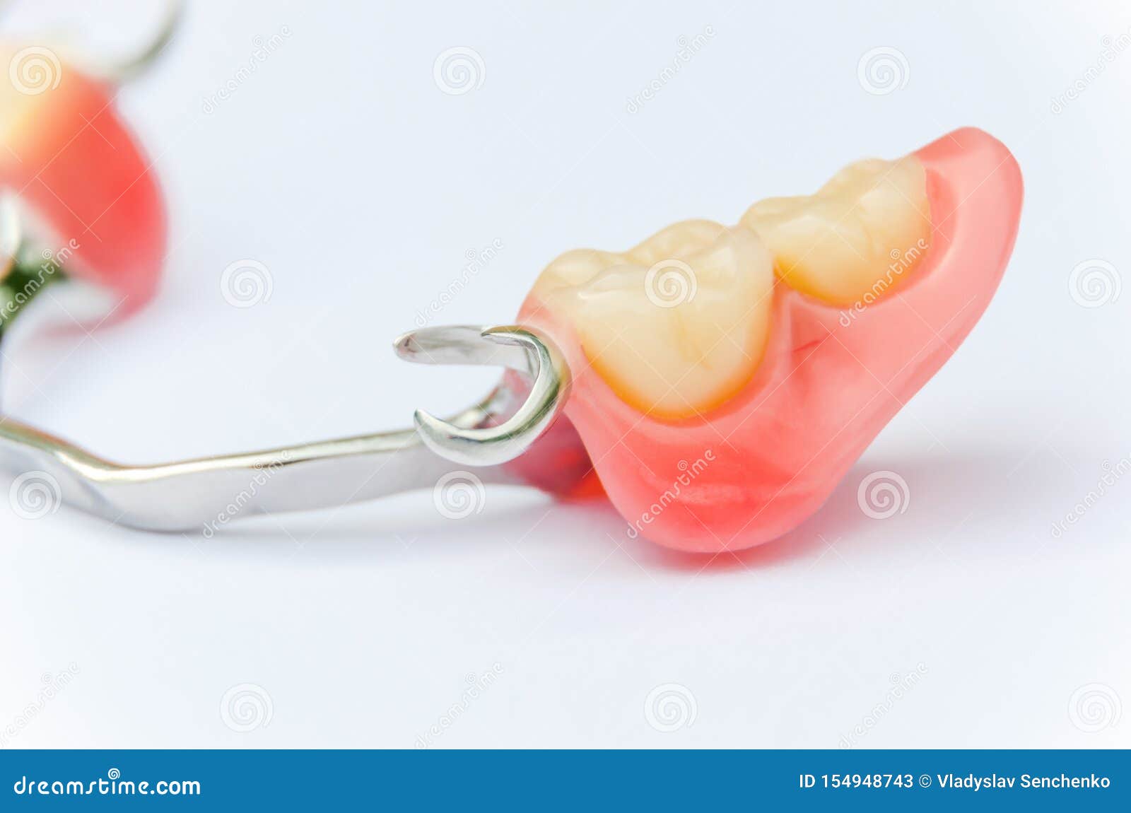 Clasp Prosthesis on the Lower Jaw Stock Image - Image of arch, fixation ...