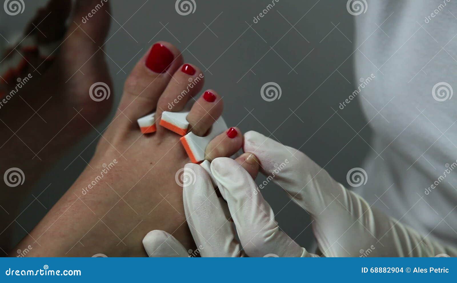 Clavo Que Pule En Los Dedos Del Pie Metrajes - Vídeo de punta ...