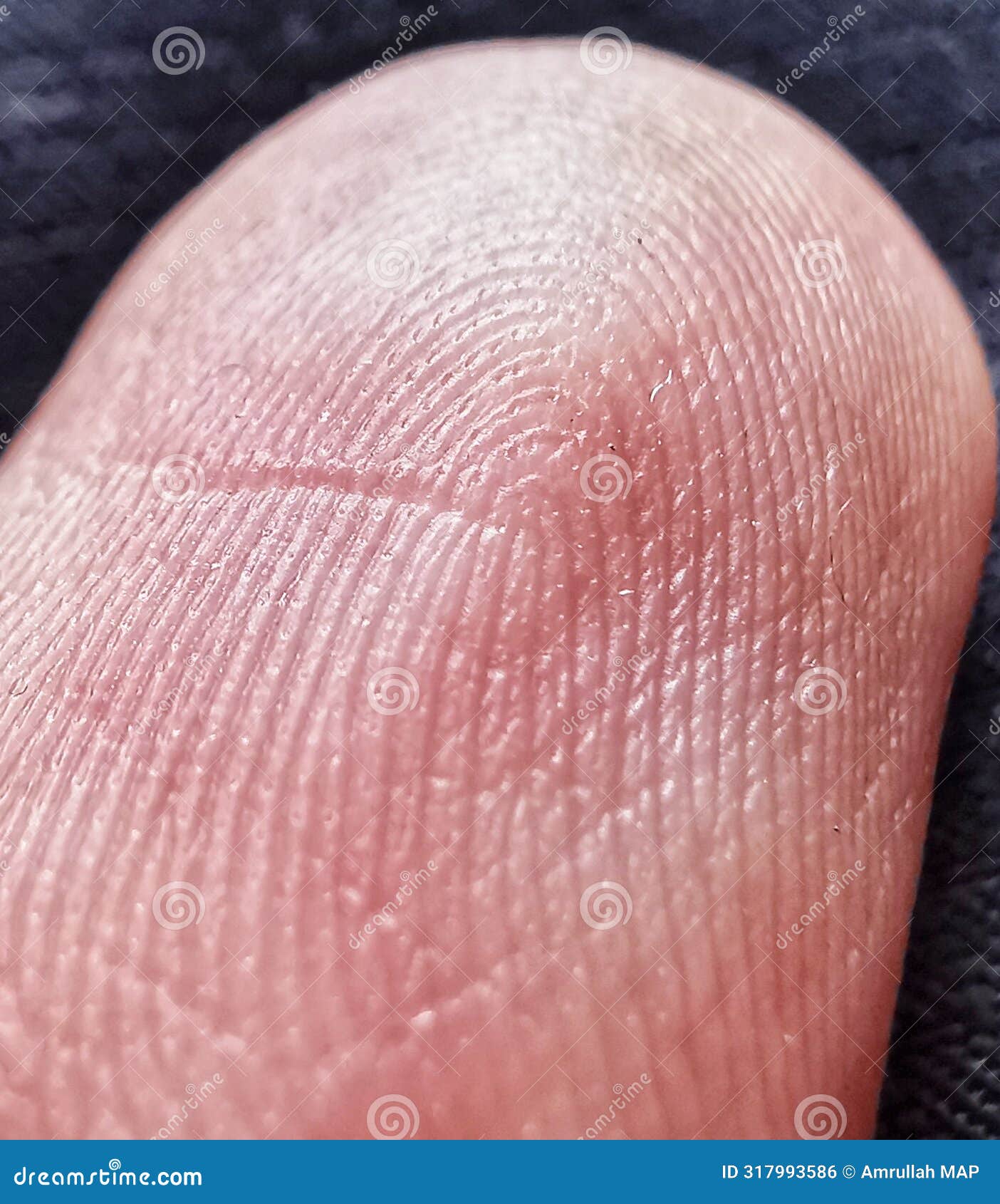 Clean Fingerprints without Germs Stock Photo - Image of fingerprints ...