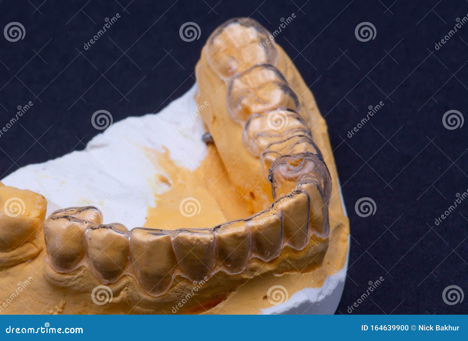 Clear Aligner or Retainer for the Teeth for Orthodontic Patients on a ...