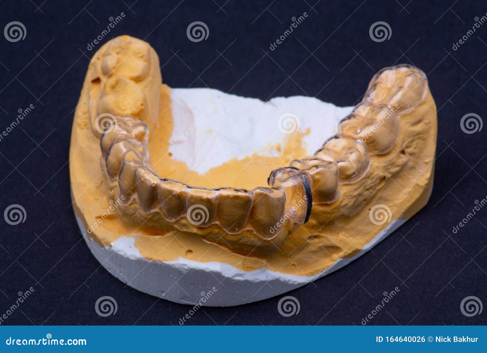 Clear Aligner or Retainer for the Teeth for Orthodontic Patients on a ...