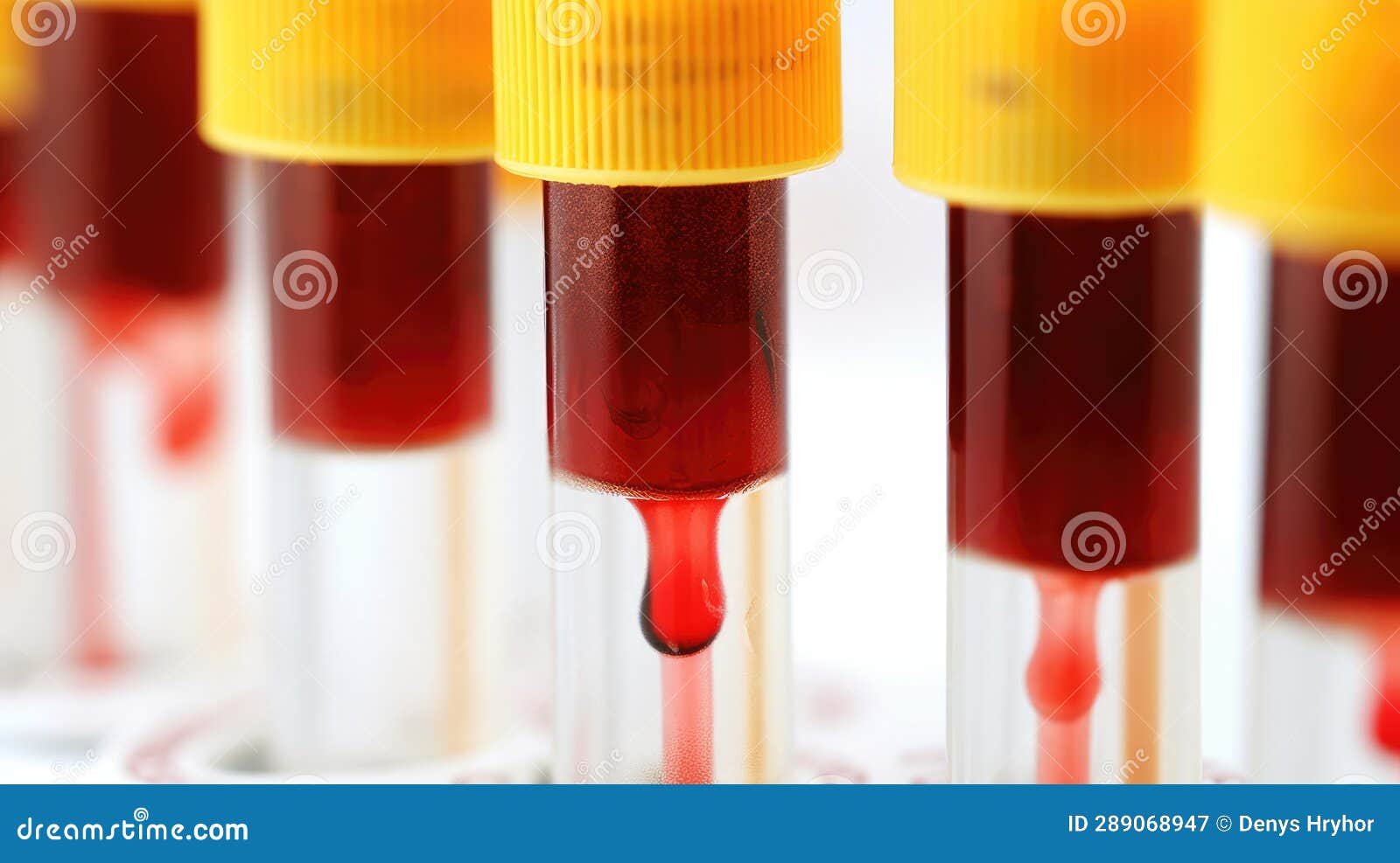 Clear Glass Test Tubes with Liquid Sample for Testing. Blood Analysis ...