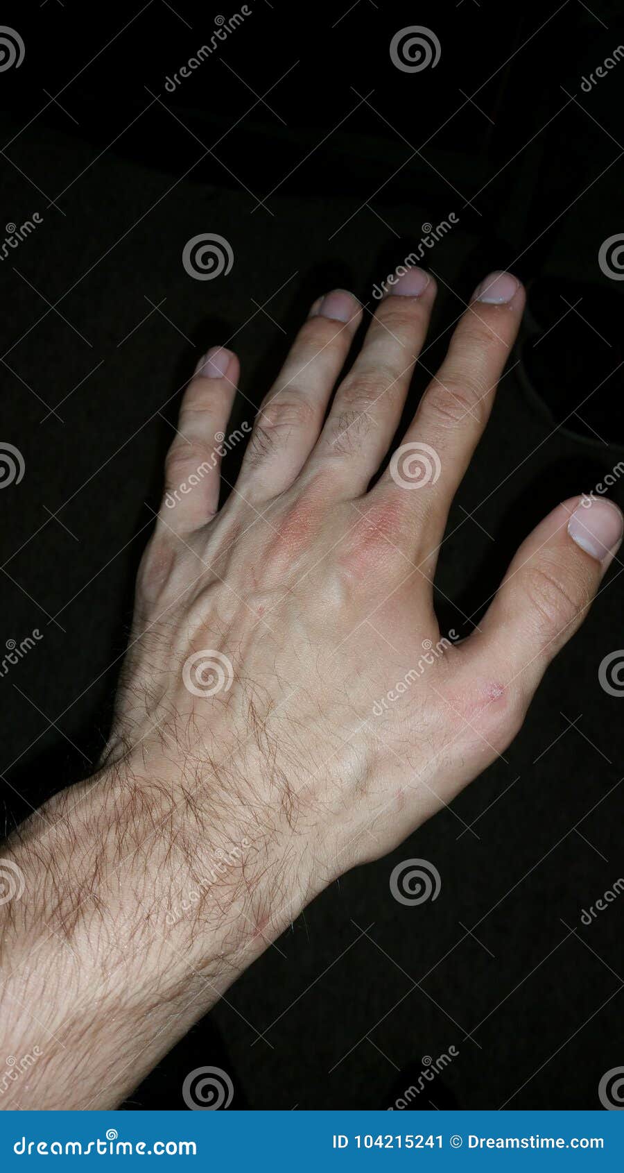 Clear hand stock image. Image of clear, nice, hand, aesthetic - 104215241