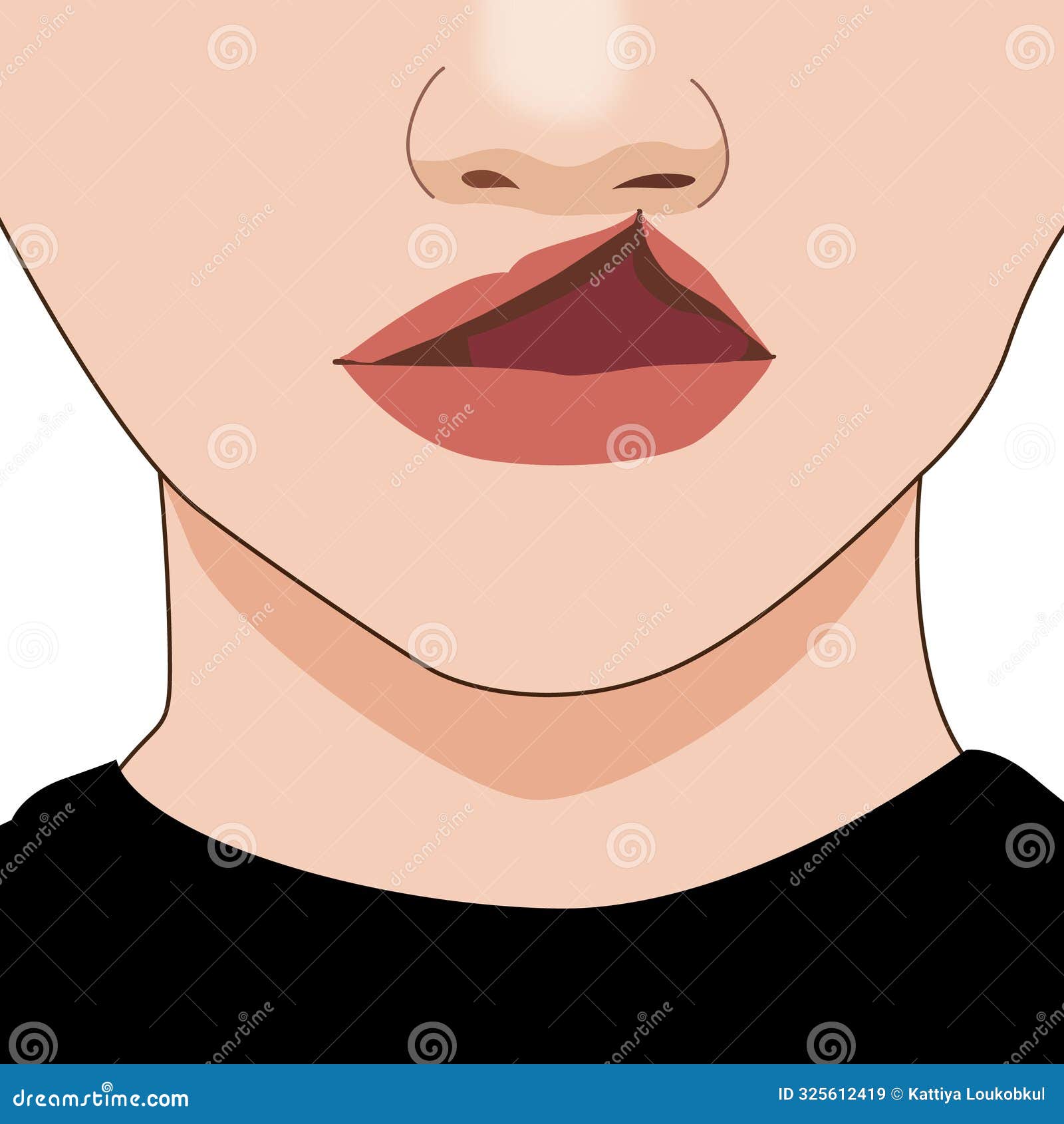 Cleft Lip And Cleft Palate, Illustration On White Background ...