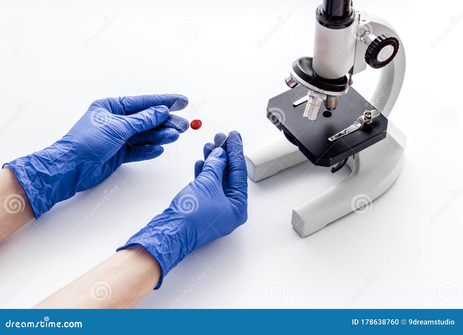 Clinical Science Research With Microscope. Blood Sample In Hands On ...