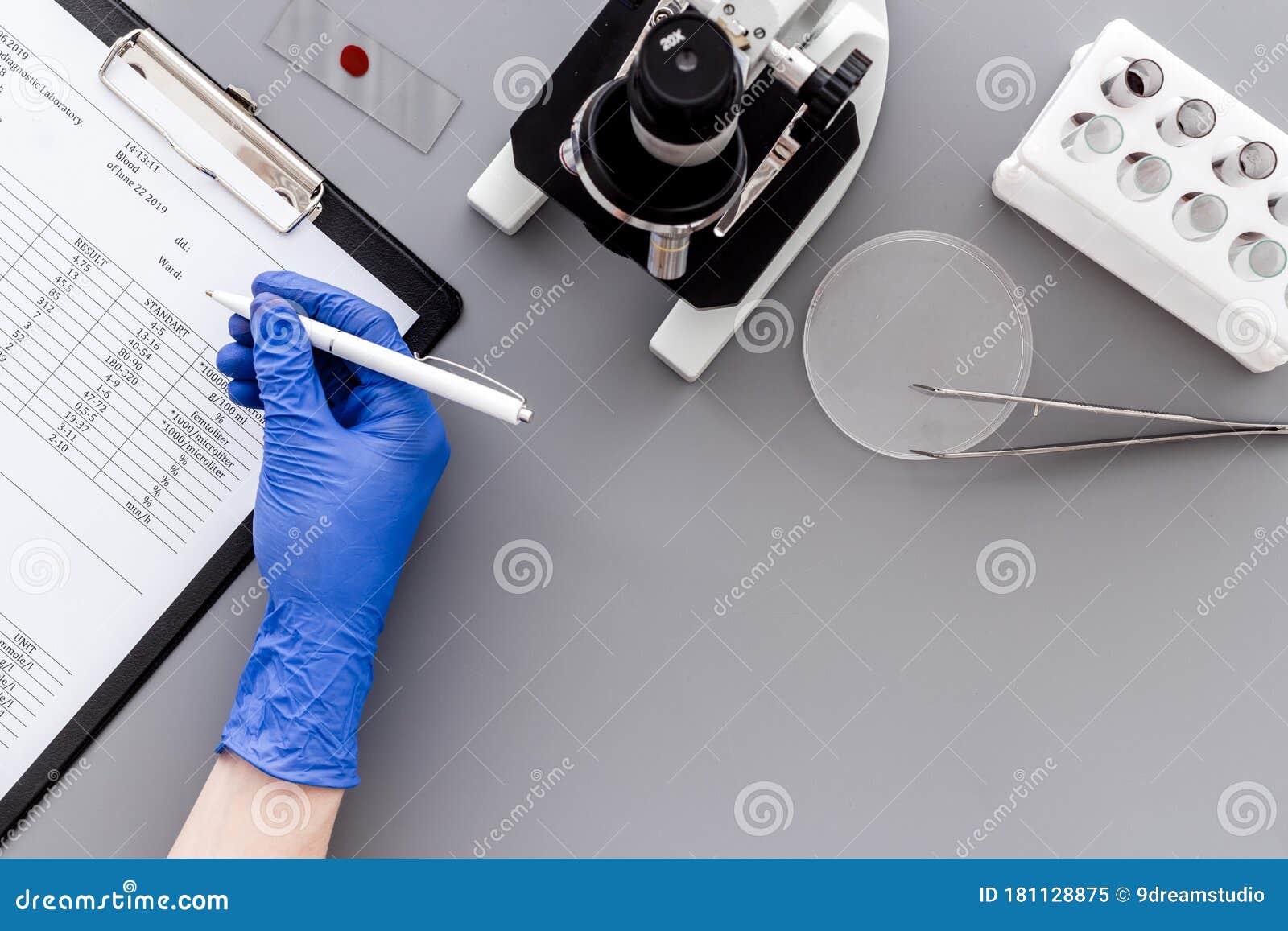 Clinical Science Research with Microscope. Hand Writes Test Results on ...