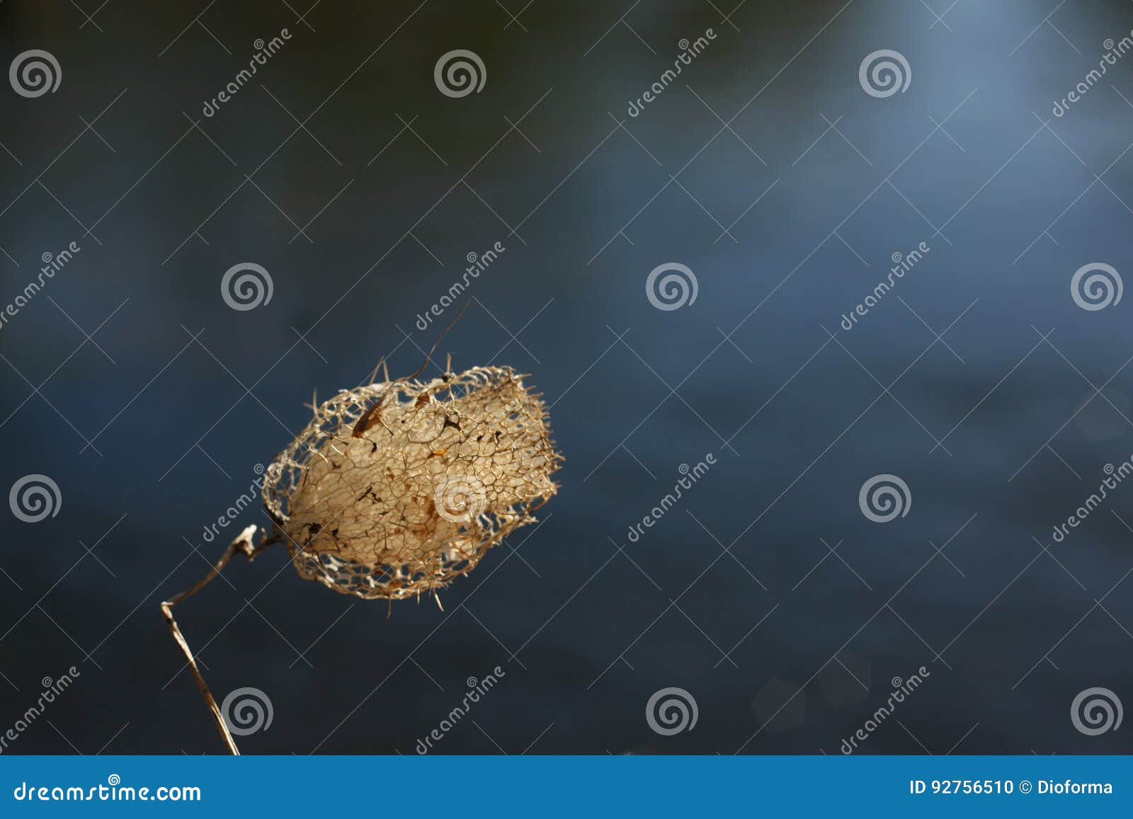 Close Up Photos Of Foot Blue Splint For Treatment Of Injuries From ...