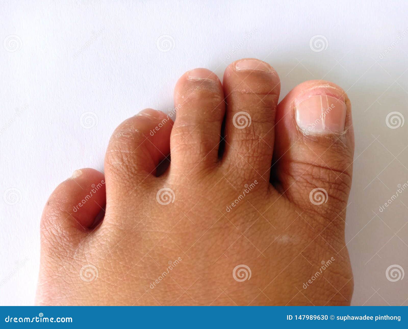 Close Up the Toes Back Image on White Background Stock Photo - Image of ...