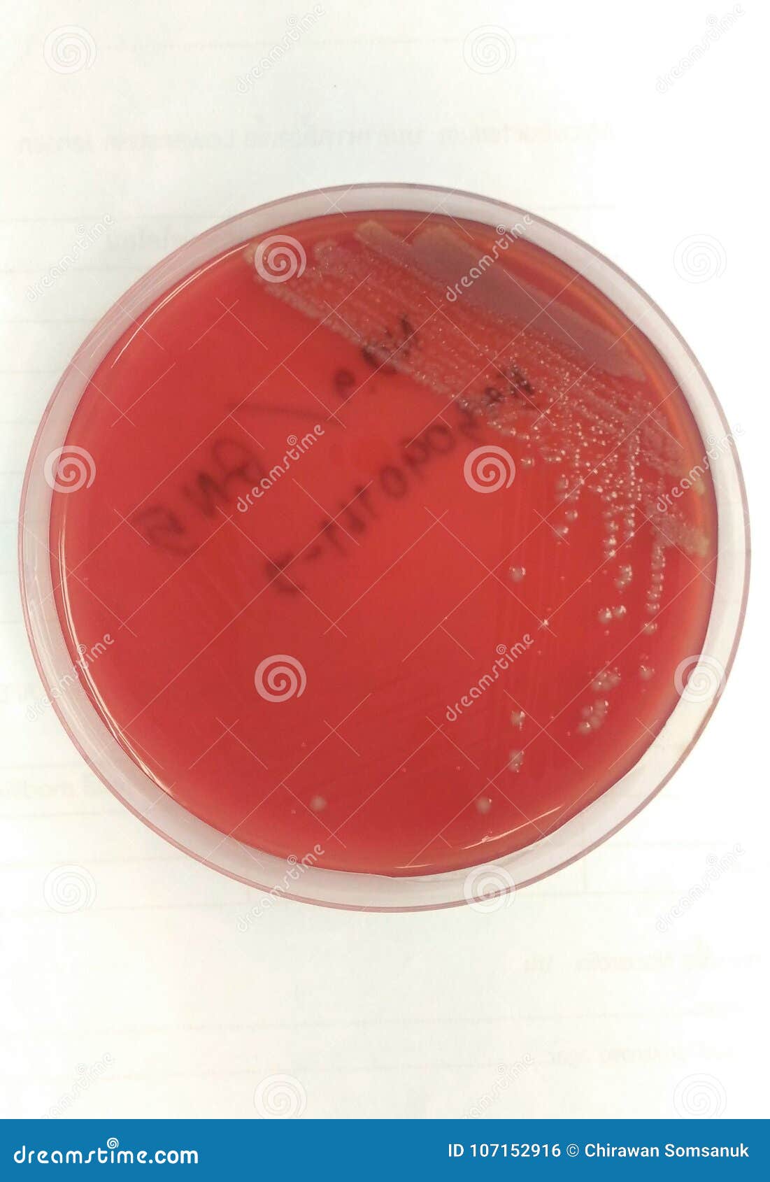 Biochem Test Automate For Identified Pathogen In Microbiology R Royalty ...