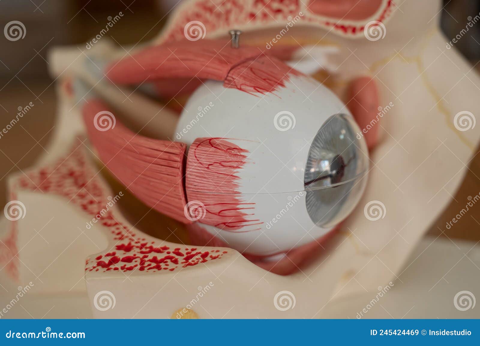 Anatomical Plastic Model Showing Pancreas, Gall Bladder With Gallstones ...