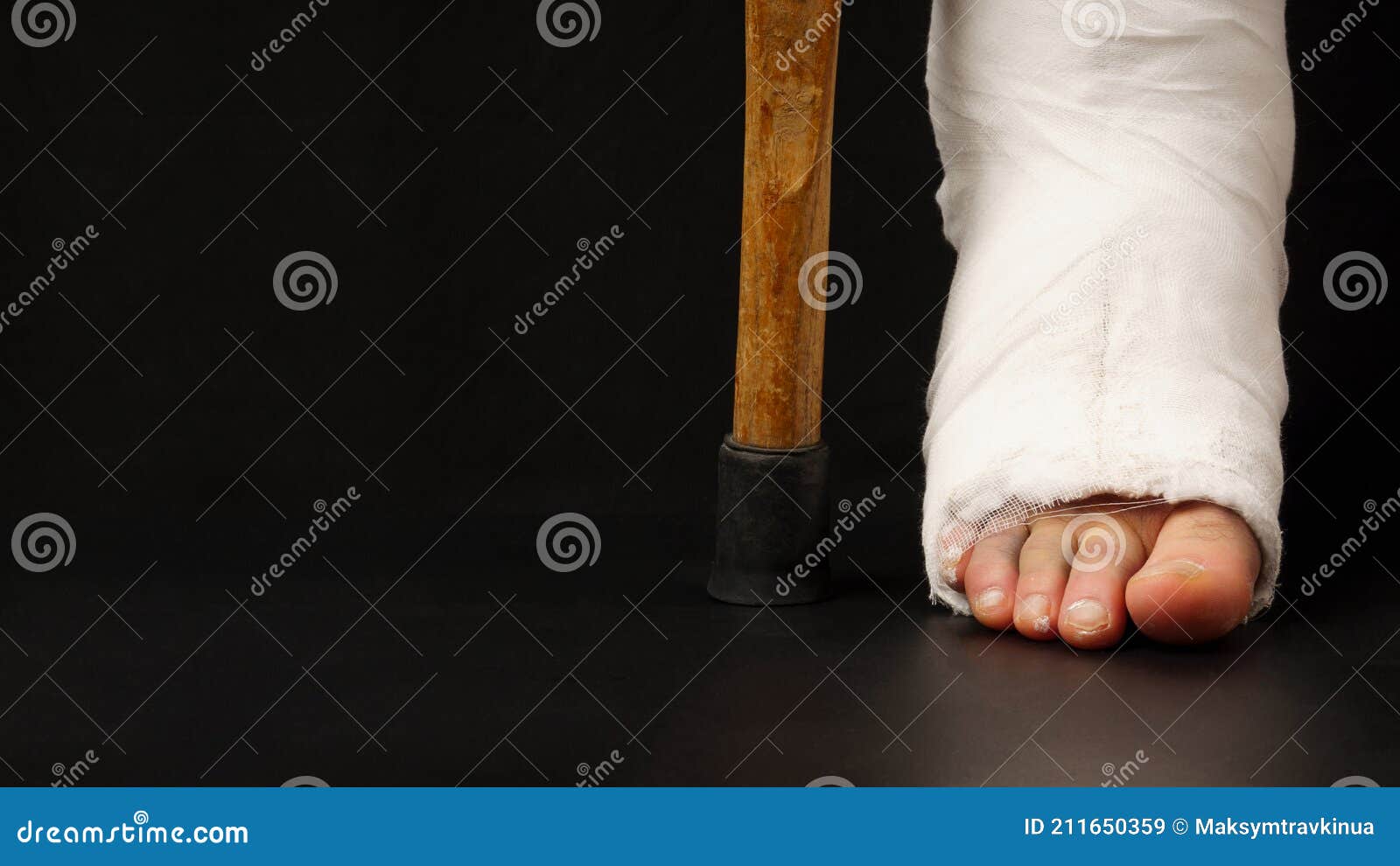 Close Up of Ankle in Plaster Cast and Crutch on Black Stock Image ...
