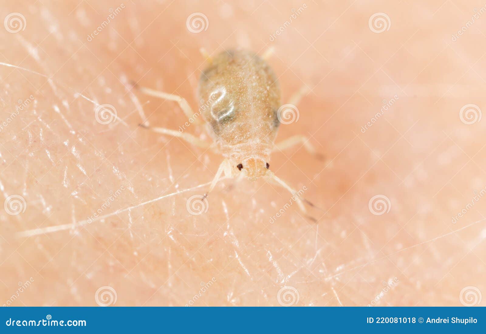 Close-up of Aphids on Human Skin. Stock Photo - Image of skin, closeup ...