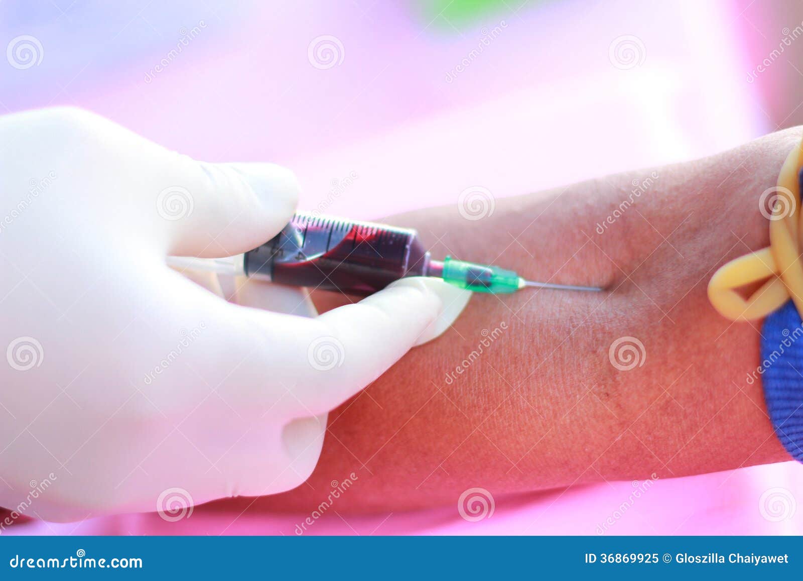 Close Up of Blood Extraction in Lab Stock Image - Image of body ...