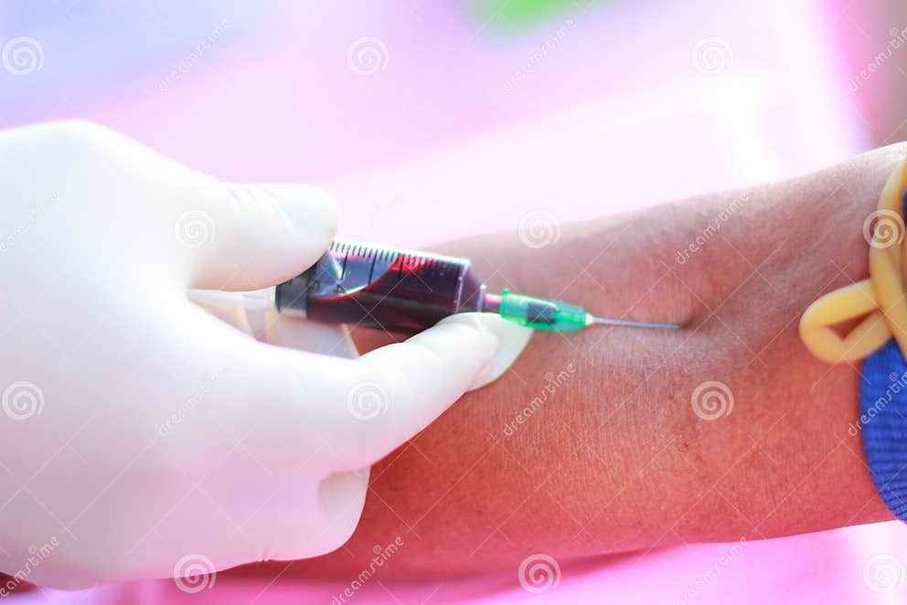 Close Up of Blood Extraction in Lab Stock Image - Image of body ...
